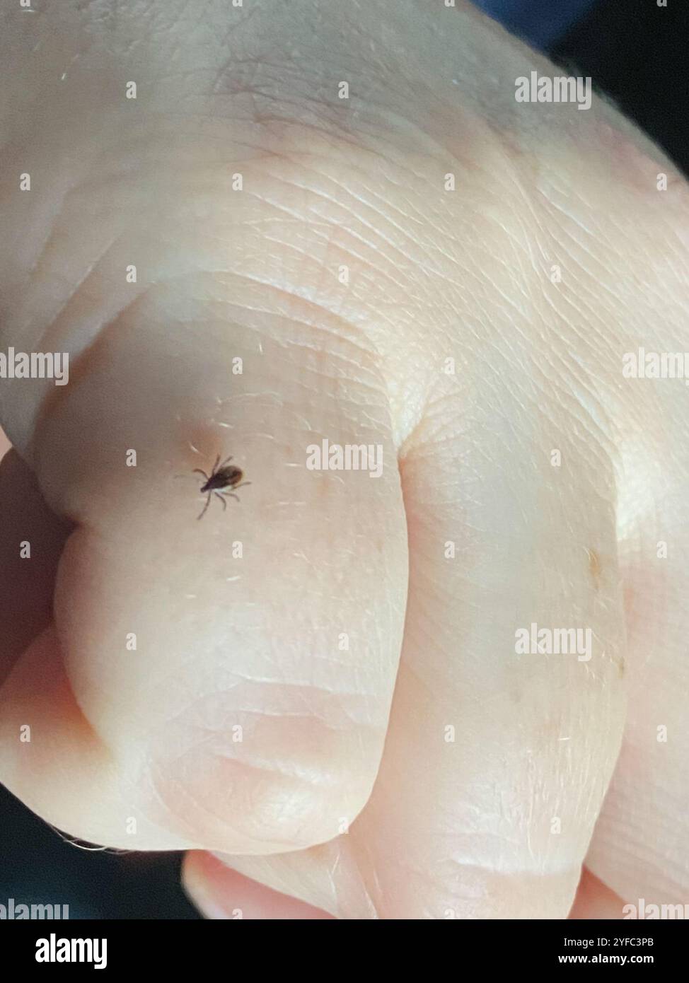 taiga tick (Ixodes persulcatus Stock Photo - Alamy