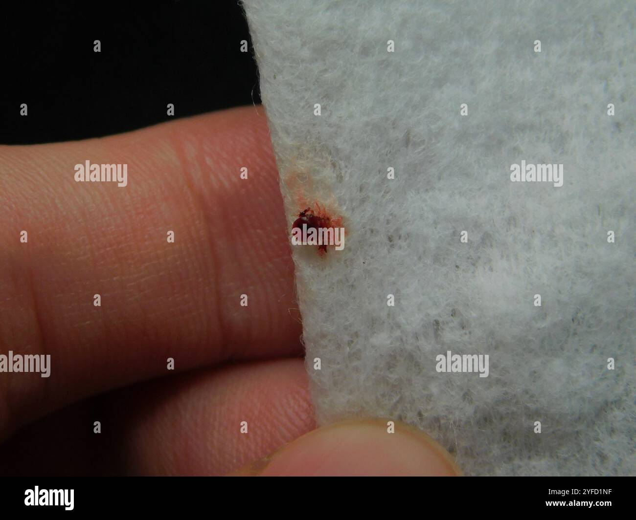 Bed Bugs (Cimicidae Stock Photo - Alamy