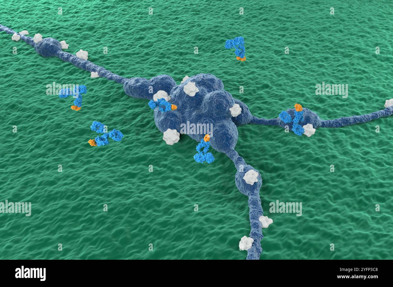 Monoclonal antibody therapy in Neuroblastoma - isometric view 3d ...