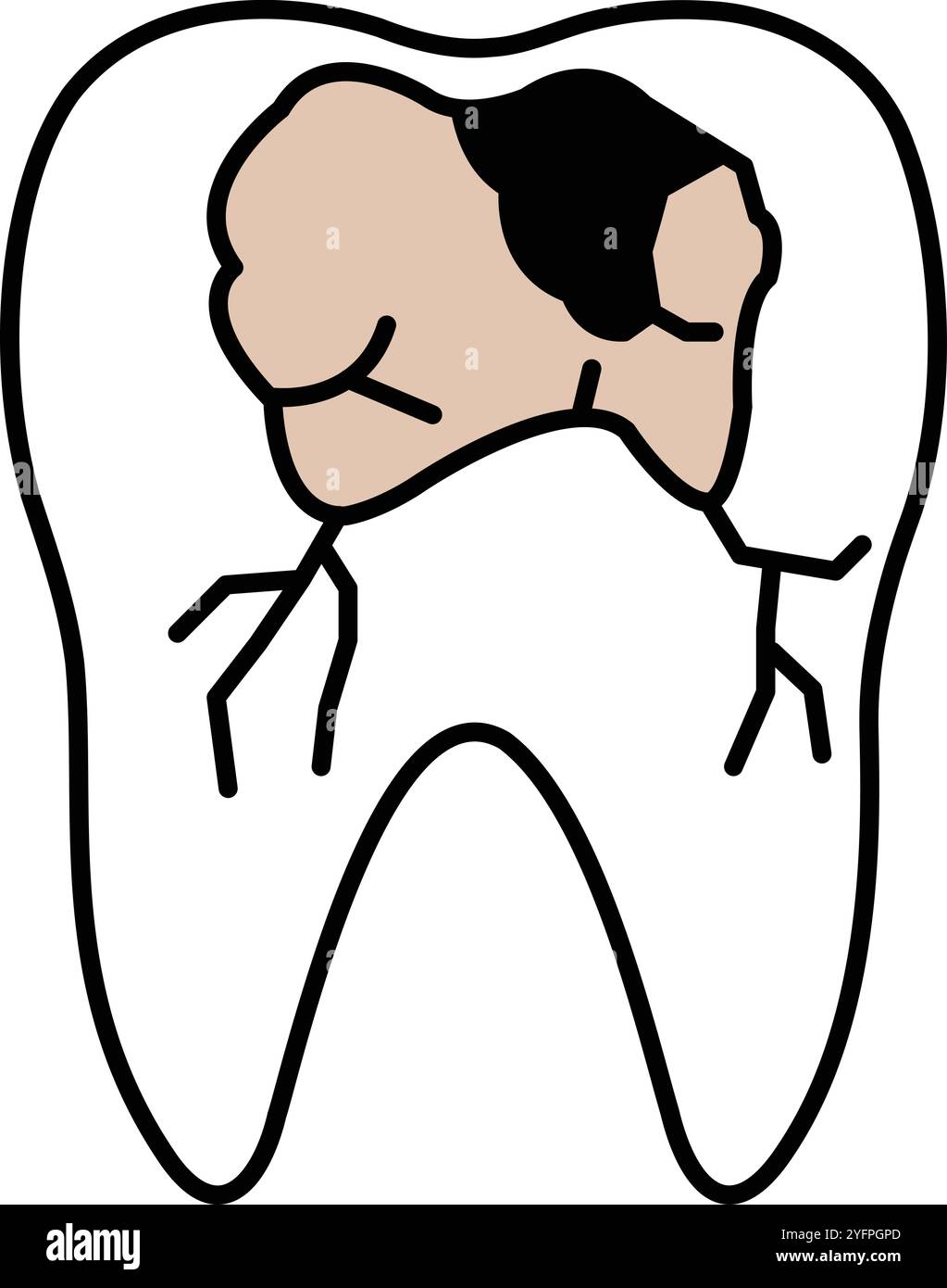 Human tooth structure Stock Vector Images - Alamy