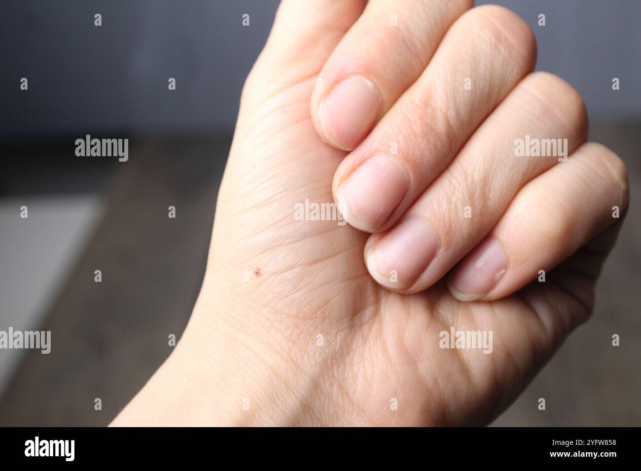 Female fingers close-up with nails without manicure. Hand and nail care ...