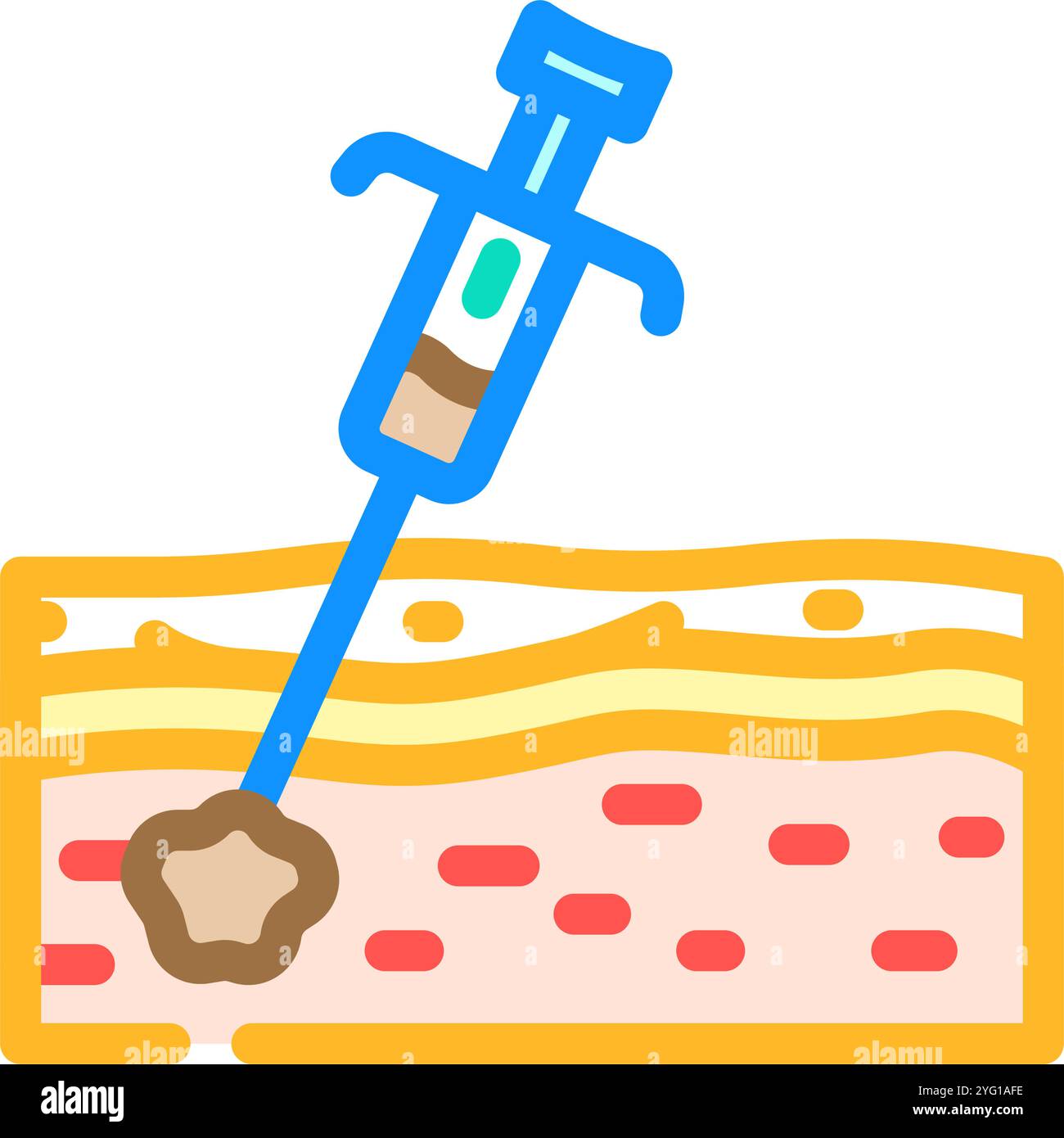 biopsy cancer treatment color icon vector illustration Stock Vector ...