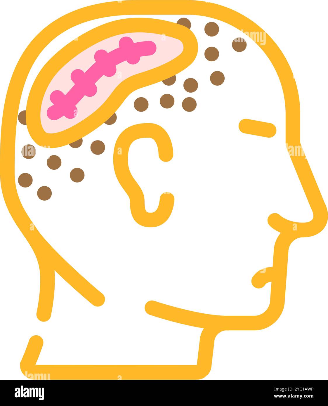 healing process cancer treatment color icon vector illustration Stock ...