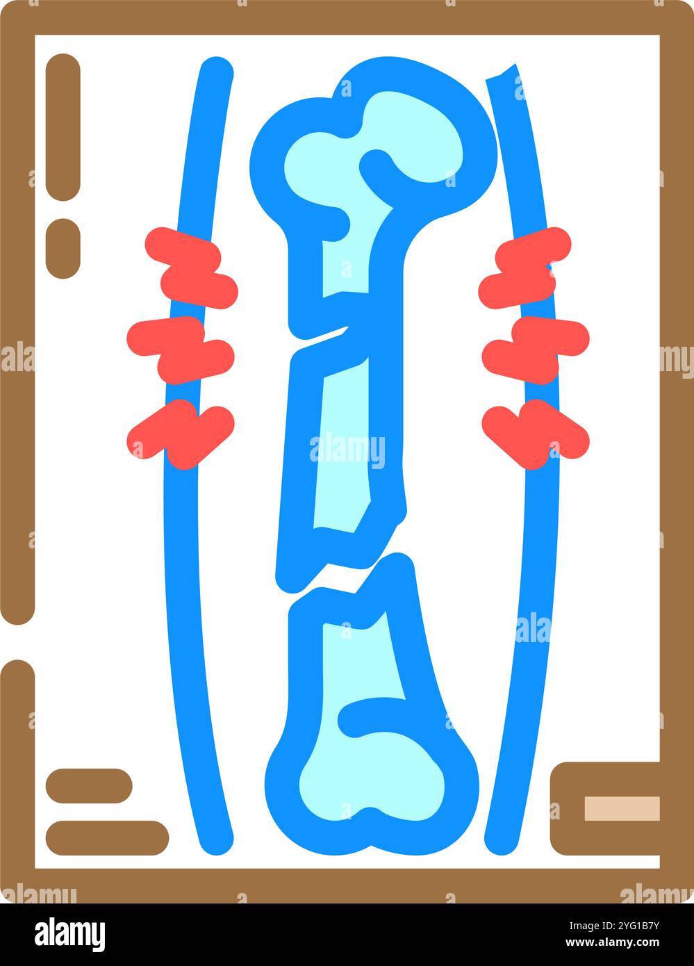 fractures household injury accident color icon vector illustration ...