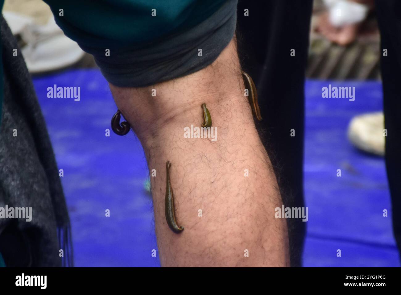 Leeches on back hi-res stock photography and images - Alamy
