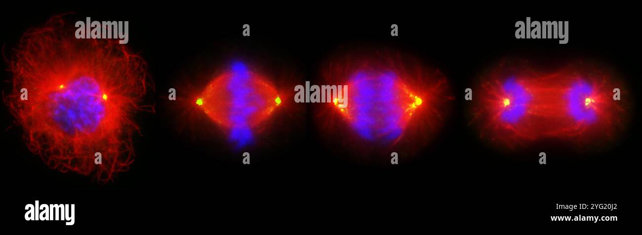 Fluorescent light micrograph of cultured human cancer cells during ...
