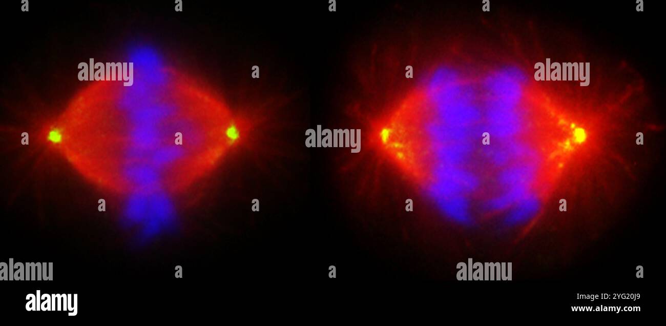 Mitosis, light micrograph Stock Photo - Alamy