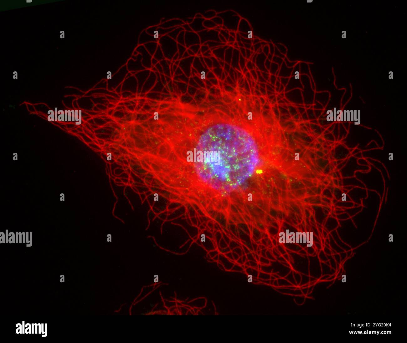 Fluorescent light micrograph of a cultured human cancer cell in ...