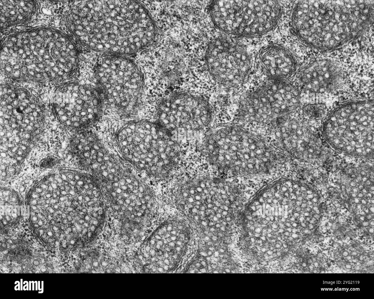 Transmission electron micrograph (TEM) of tubular mitochondria in the ...