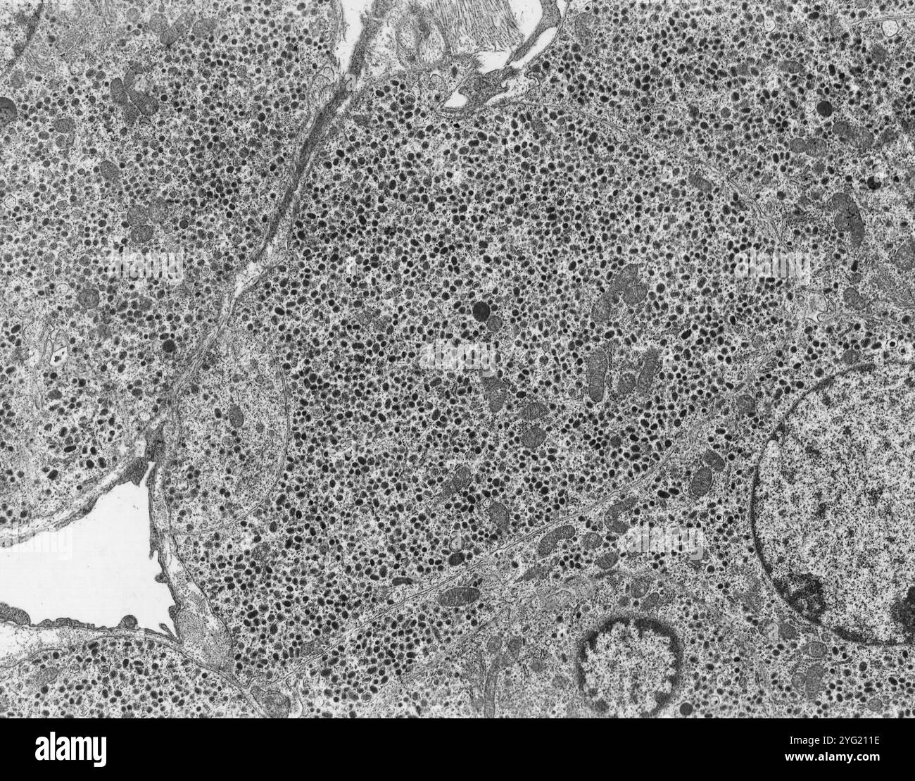Transmission electron micrograph (TEM) showing the most abundant cell ...