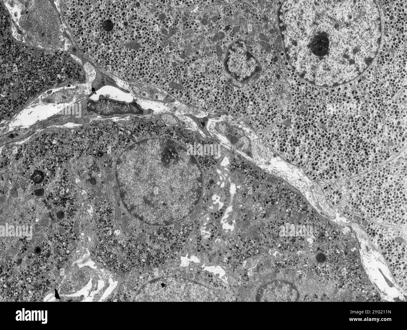 Transmission Electron Micrograph Tem Showing The Two Cell Types Of