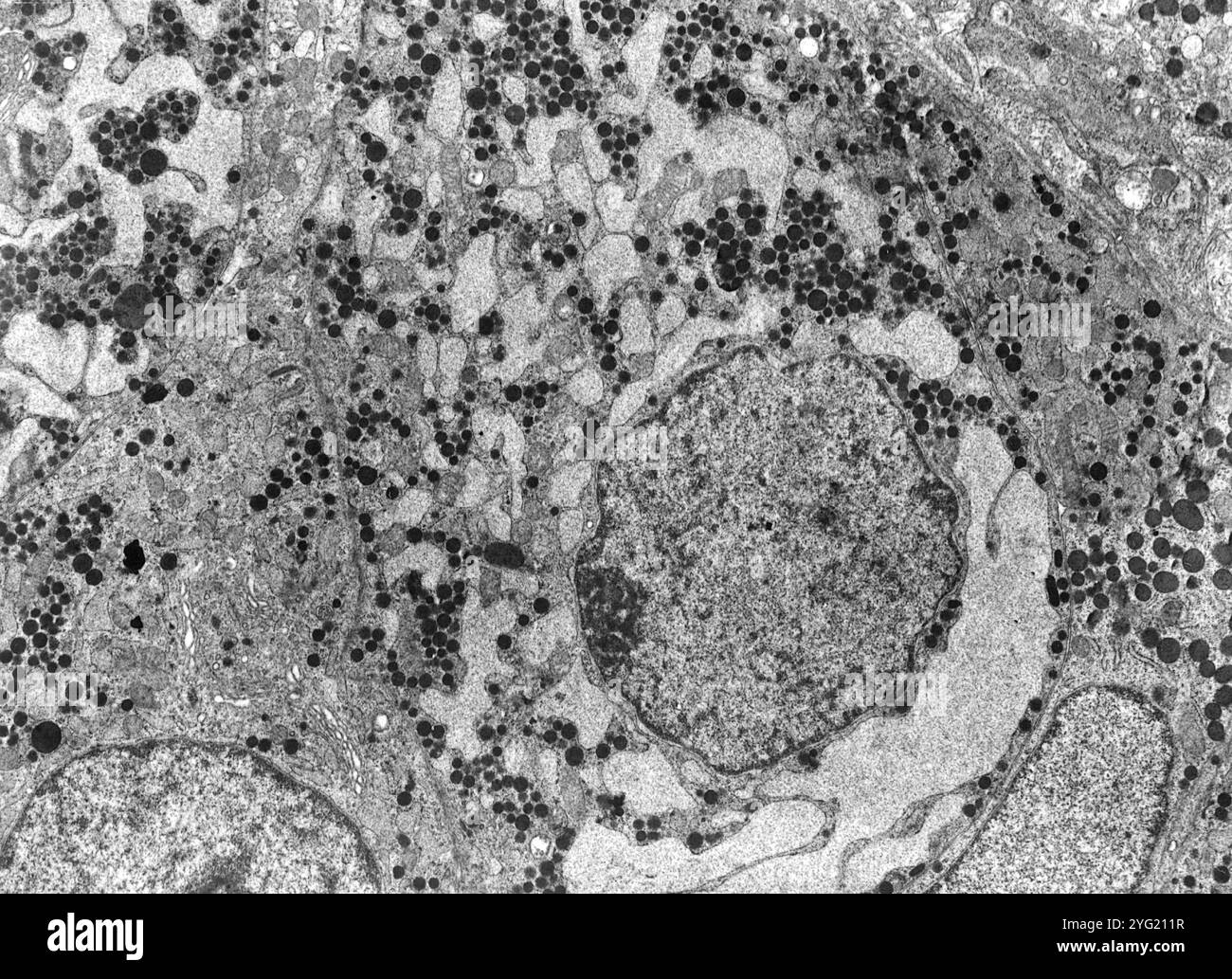Transmission electron micrograph (TEM) showing very large dilations in ...