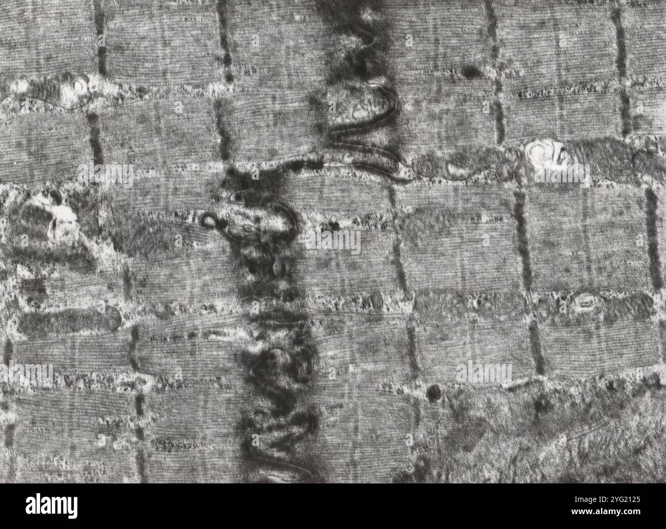 Transmission electron micrograph (TEM) showing dark lipofuscin granules and abundant ...
