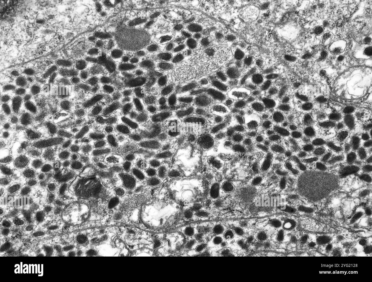 Transmission electron micrograph (TEM) showing the granules of a ...