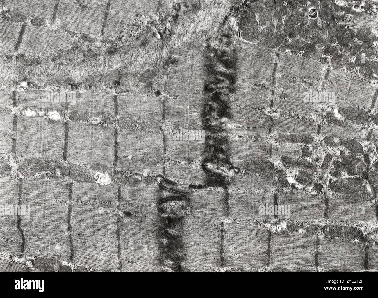 Transmission electron micrograph (TEM) showing heart muscle cells ...