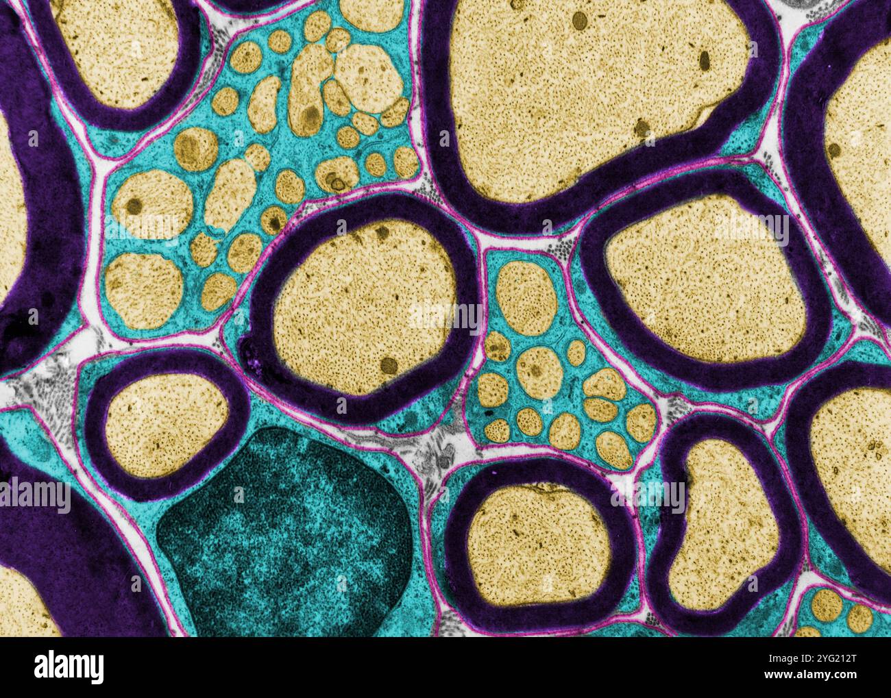 Coloured transmission electron micrograph (TEM) showing several unmyelinated and myelinated ...