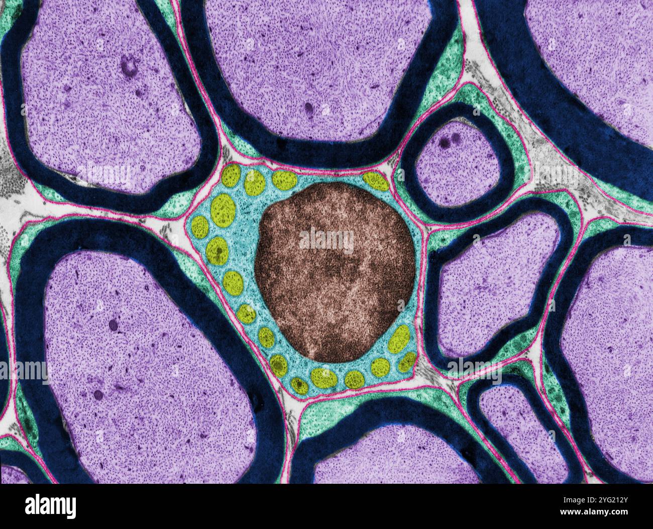 Coloured transmission electron micrograph (TEM) showing an unmyelinated ...