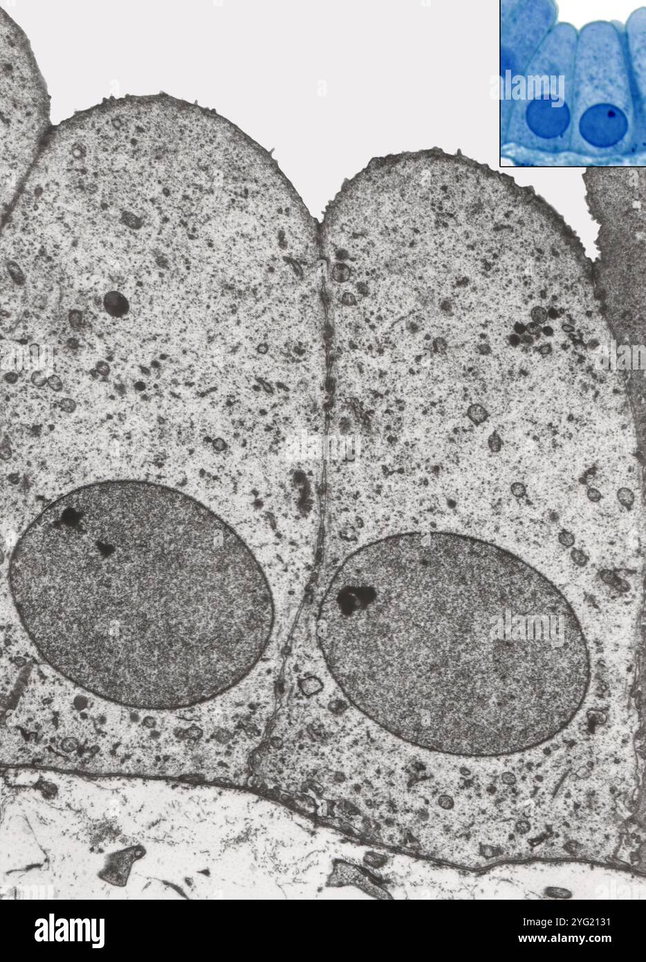Transmission electron micrograph (TEM) showing the simple columnar ...