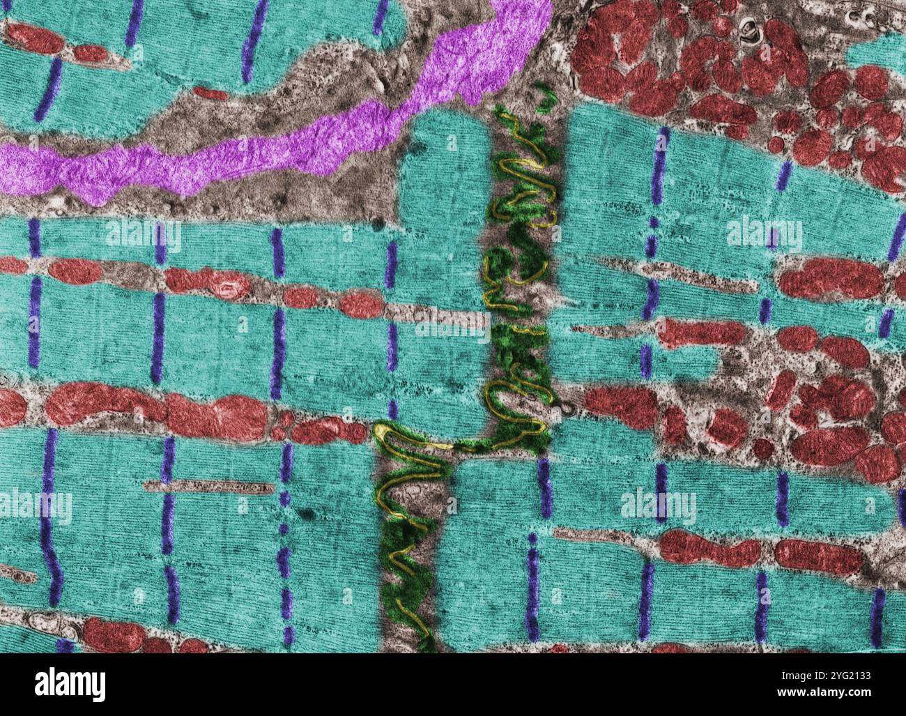 Coloured transmission electron micrograph (TEM) showing two heart muscle cells joined by an ...