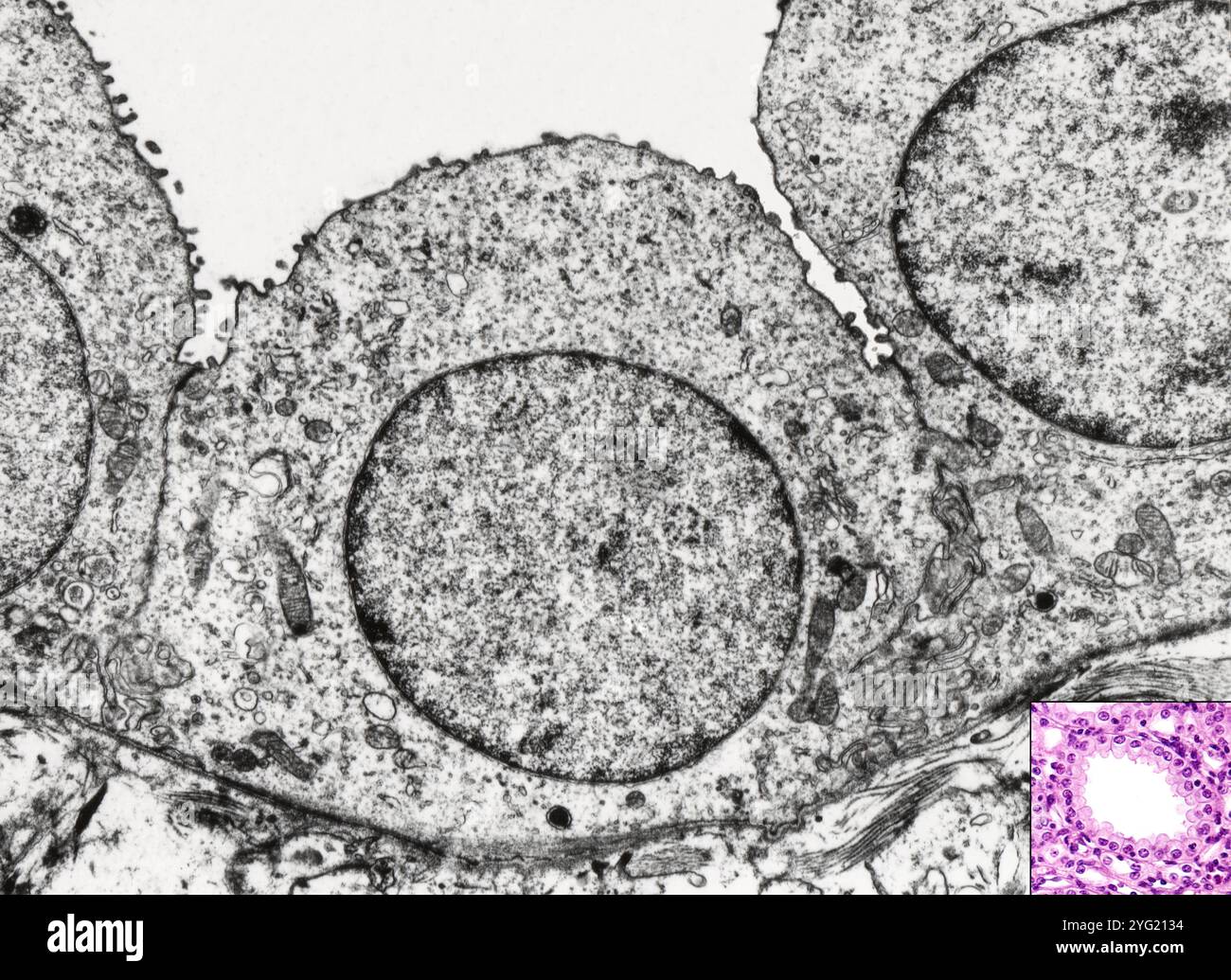 Transmission electron micrograph (TEM) showing the principal cells of a ...