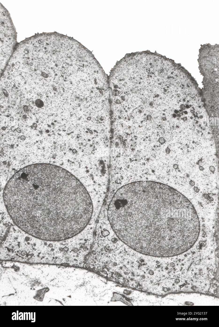 Transmission electron micrograph (TEM) showing the simple columnar ...