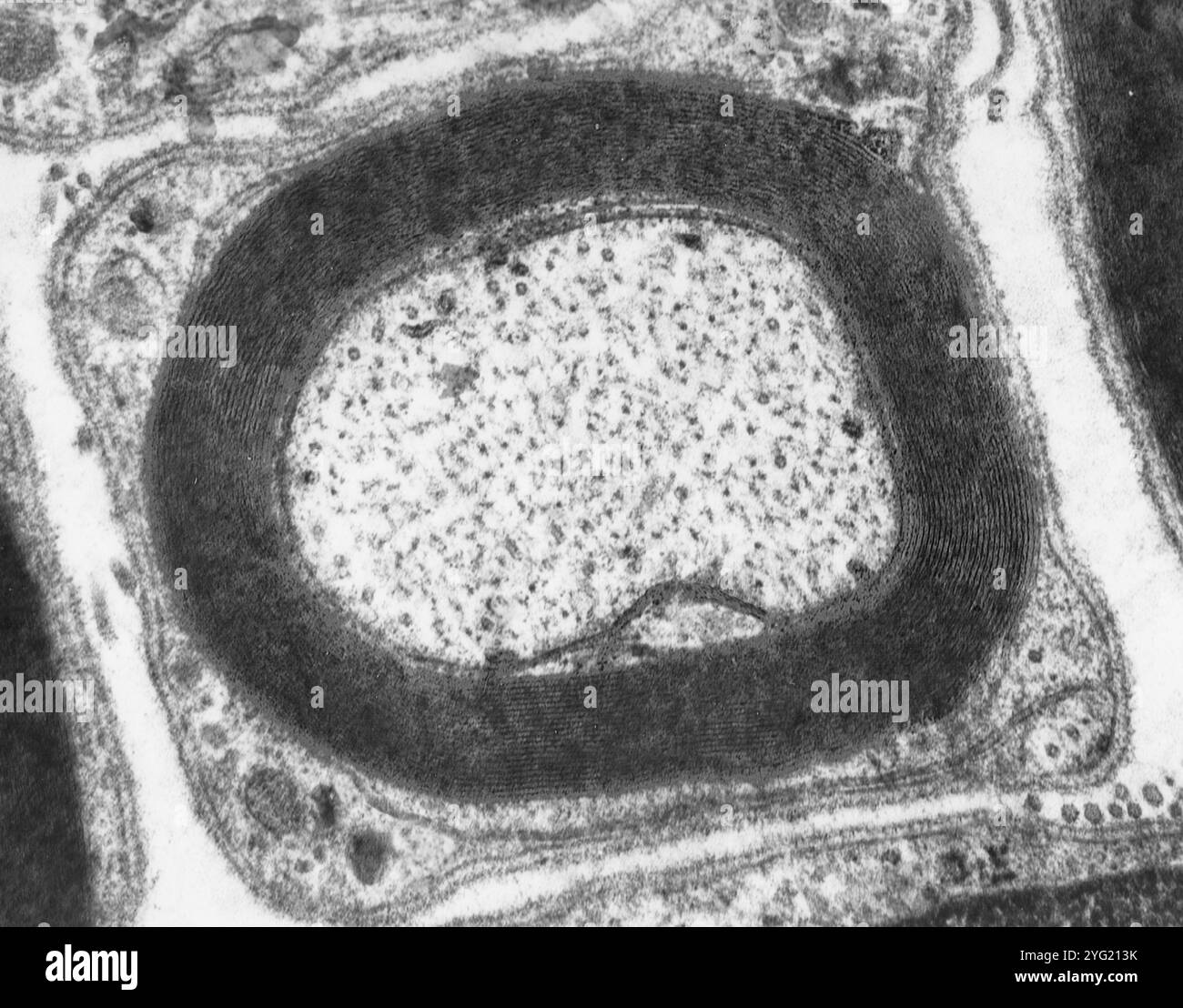 Transmission electron micrograph (TEM) of a cross-sectioned peripheral myelinated nerve fibre ...