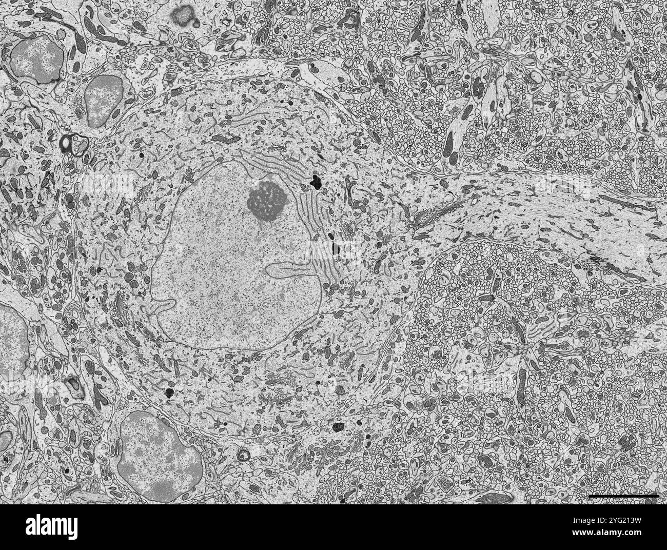 Transmission electron micrograph (TEM) of a purkinje neuron (nerve cell ...