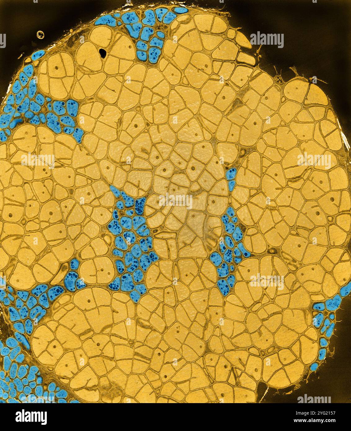 Archaea and bacteria, TEM Stock Photo - Alamy