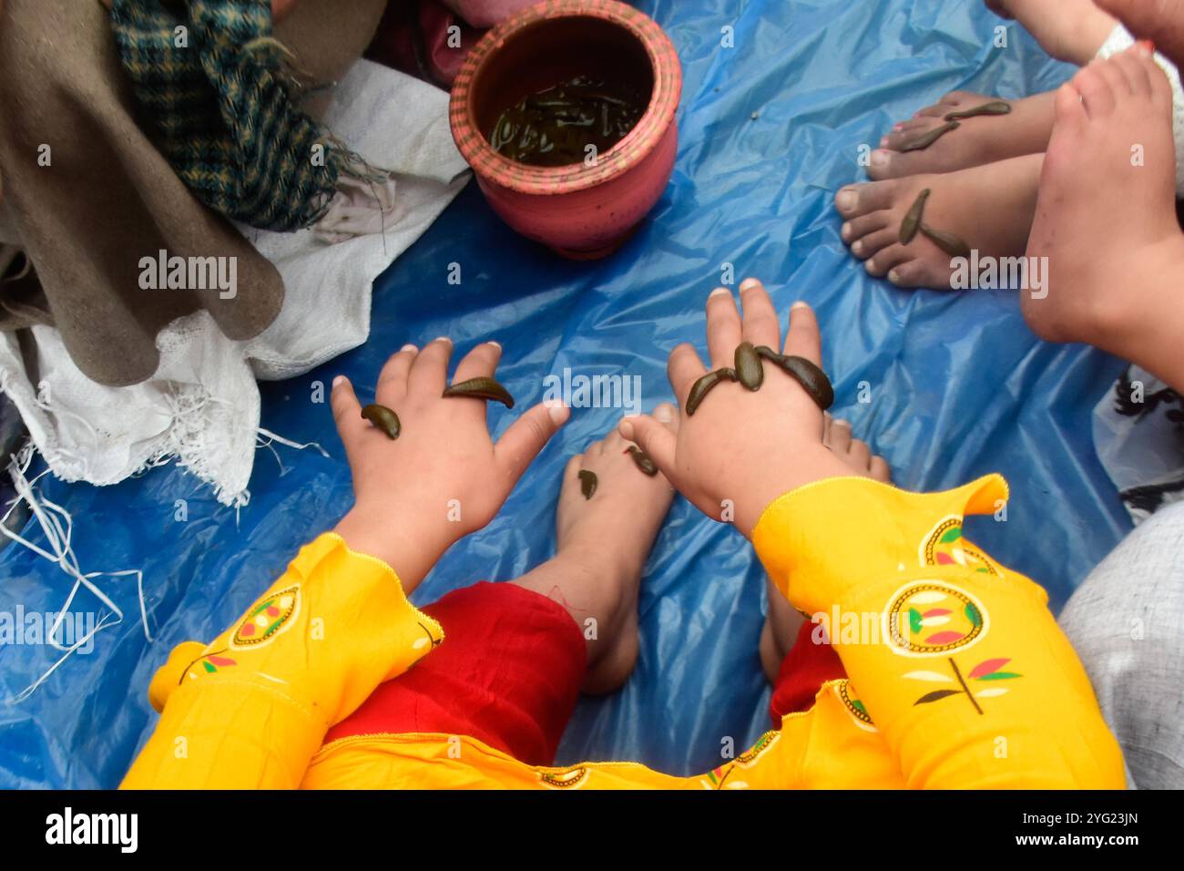 Leeches on back hi-res stock photography and images - Alamy