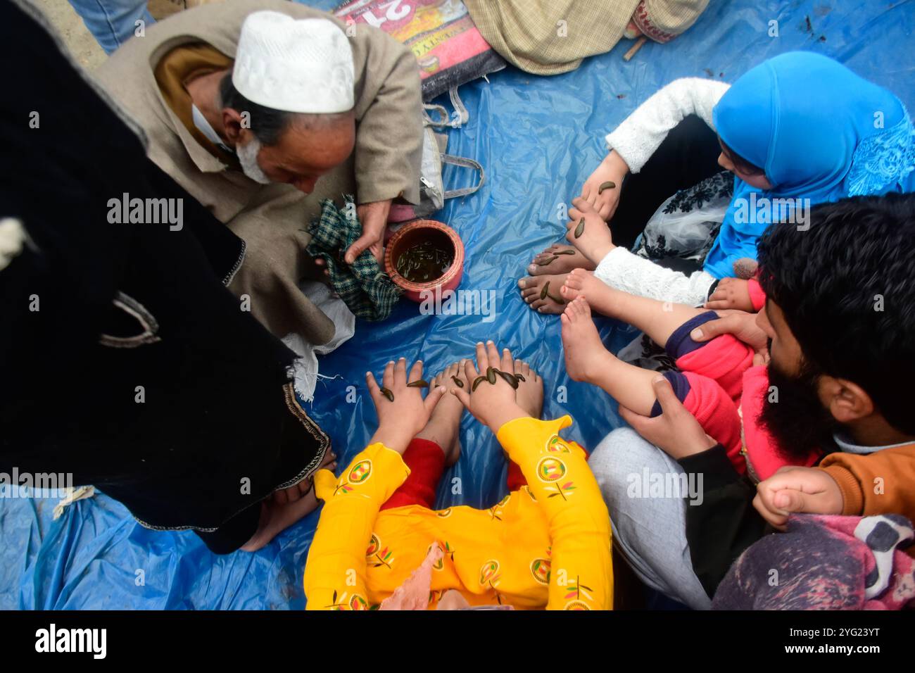 Leeches on back hi-res stock photography and images - Alamy