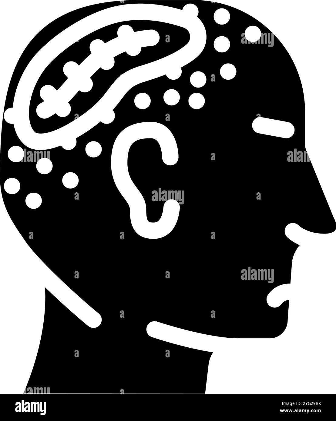 healing process cancer treatment glyph icon vector illustration Stock ...