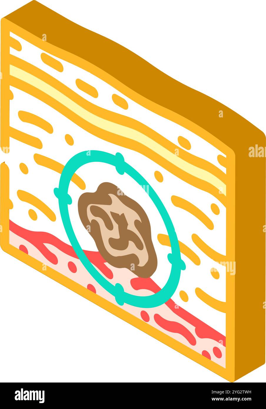 targeted therapy cancer treatment isometric icon vector illustration ...