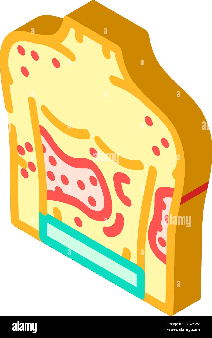 rash skin lesions disease symptom isometric icon vector illustration ...