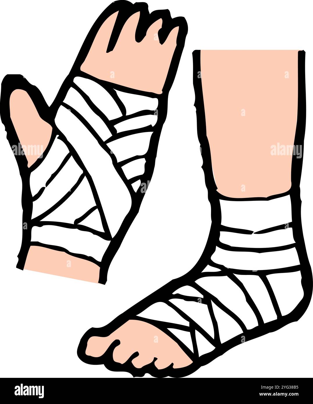 Hand and foot injuries Stock Photo - Alamy