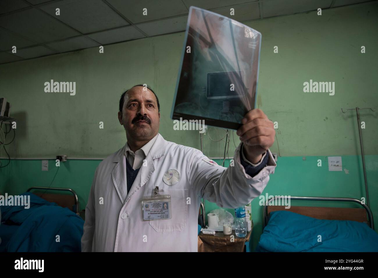 Doctor Azim Samim examines an x-ray scan of the chest of a patient ...