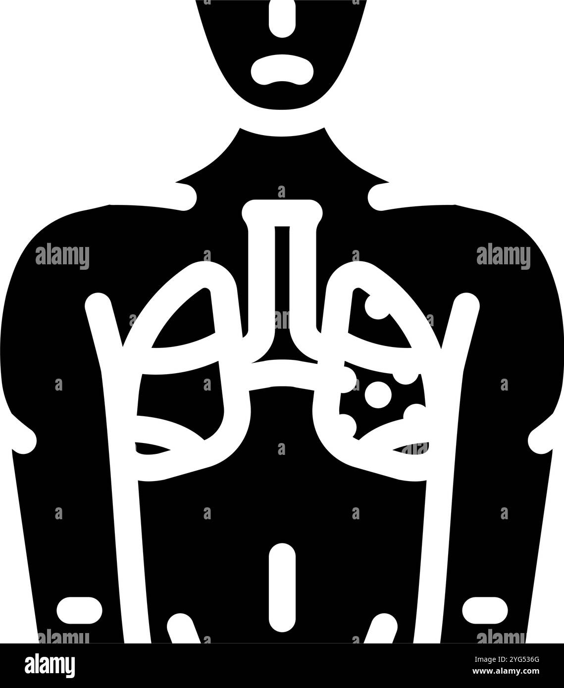 chronic obstructive pulmonary disease glyph icon vector illustration ...