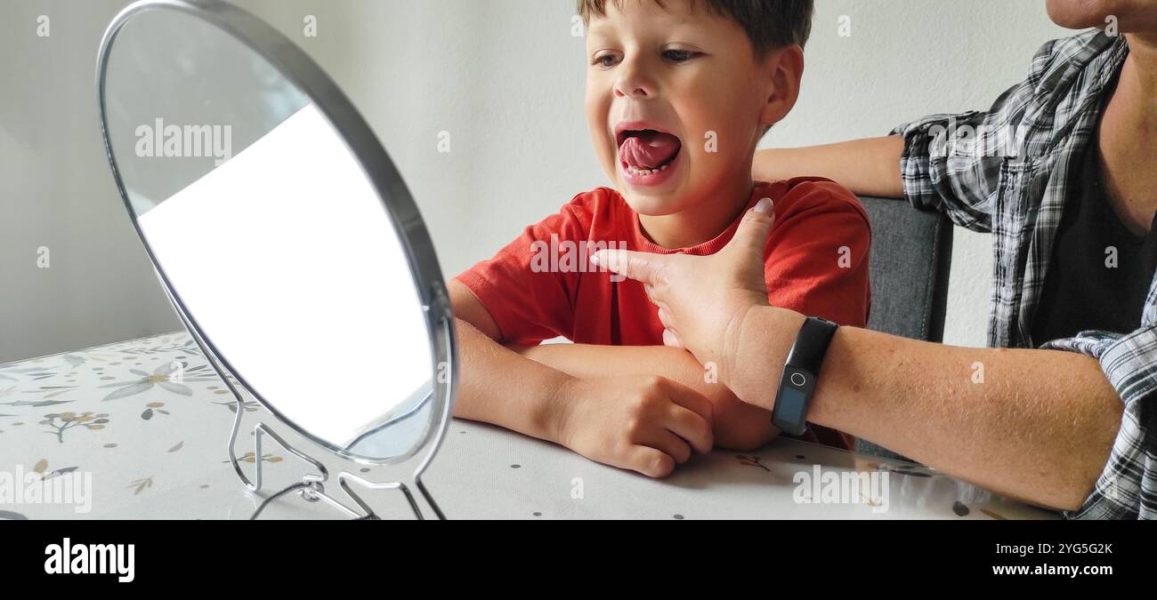 A child performs a speech therapy exercise in front of a mirror ...
