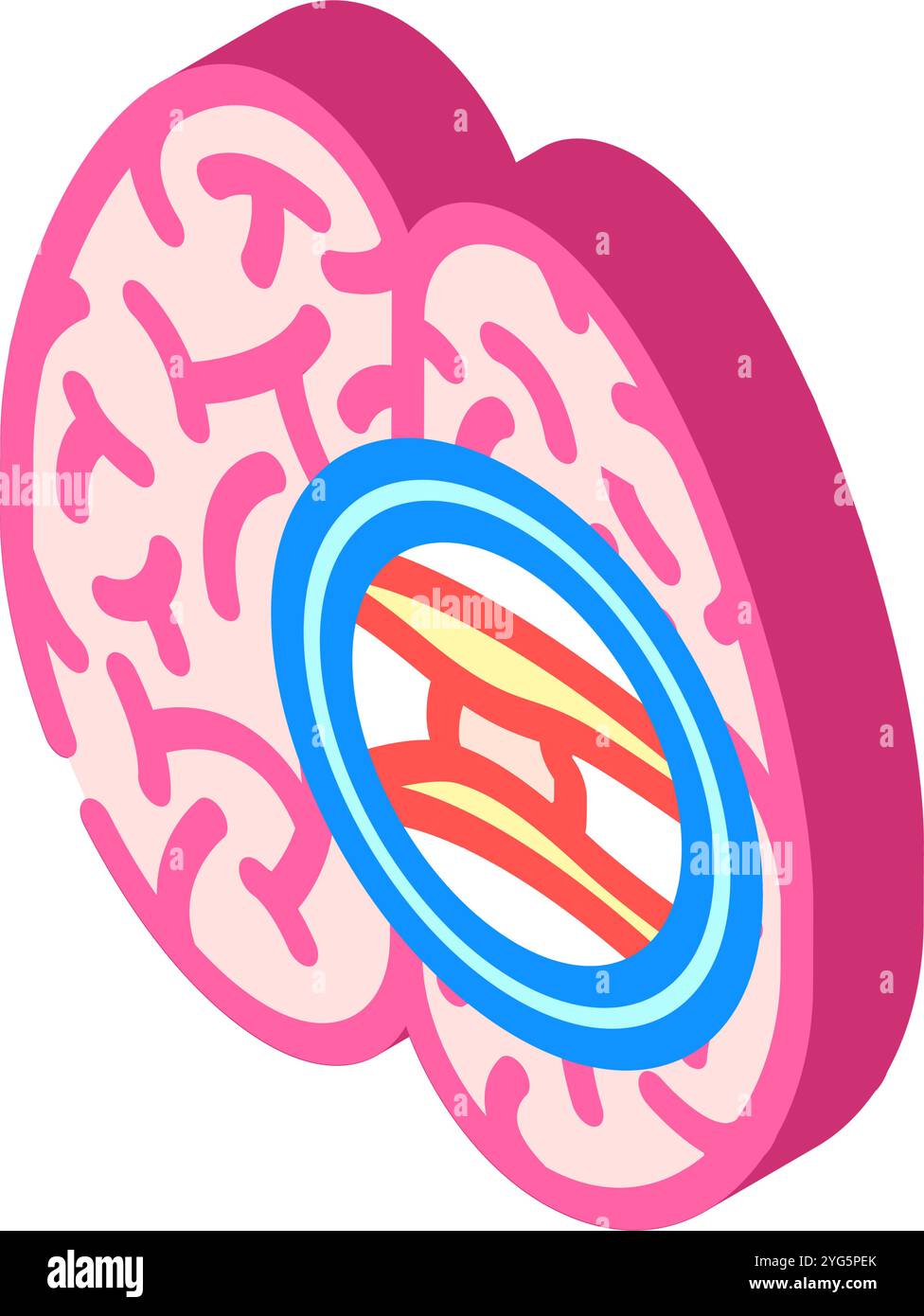 stroke man disease isometric icon vector illustration Stock Vector ...