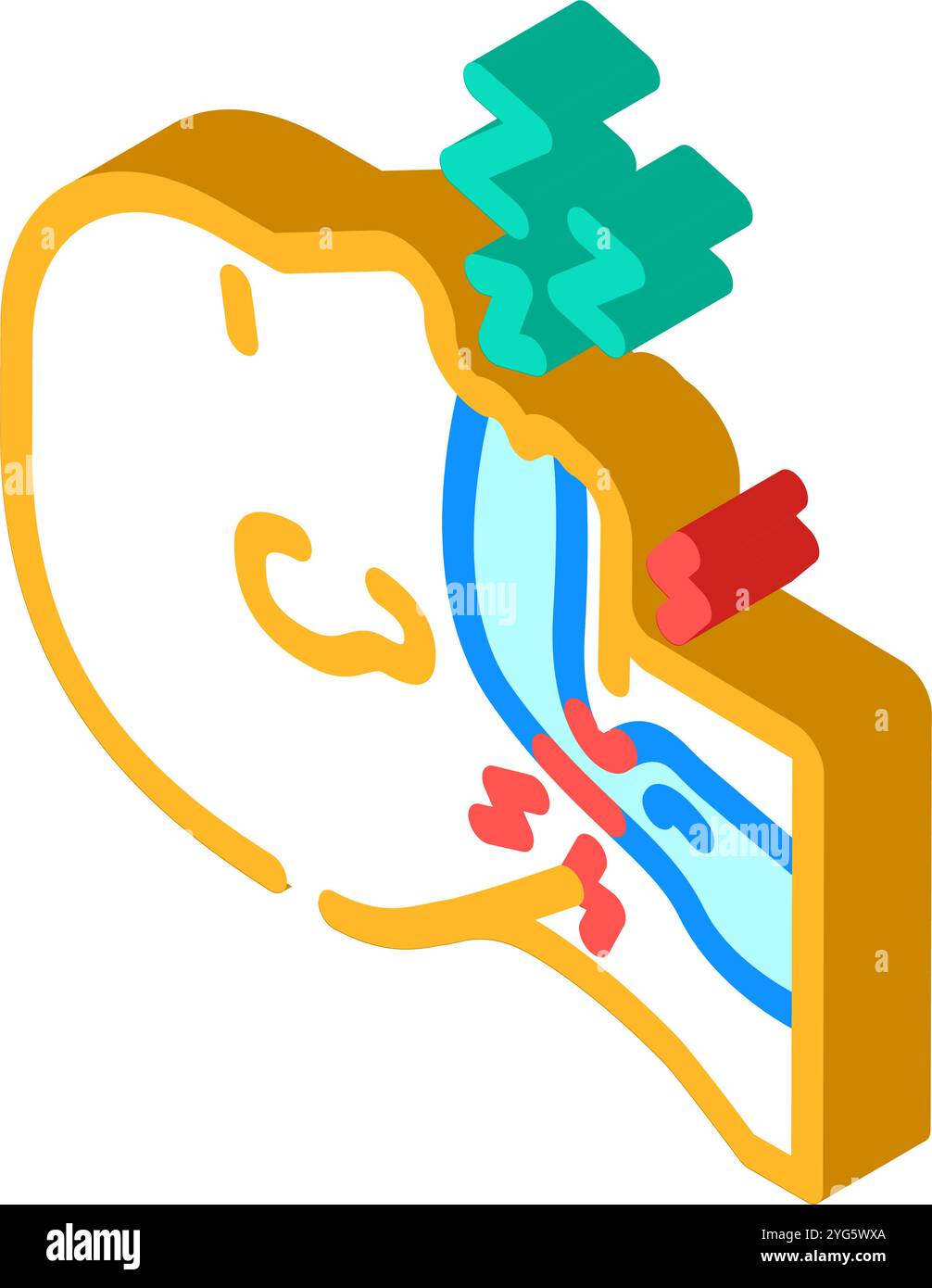 sleep apnea man disease isometric icon vector illustration Stock Vector ...
