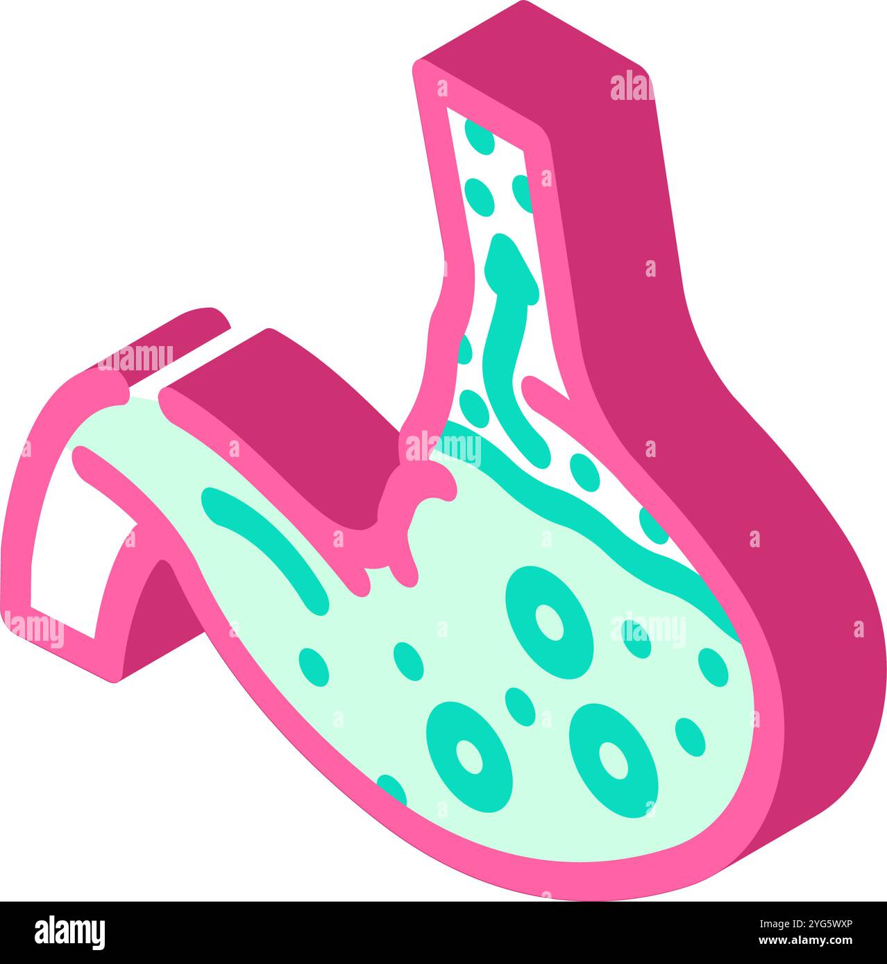 gastroesophageal reflux disease isometric icon vector illustration ...