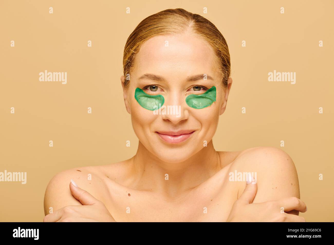 A joyful woman with eye patches smiles confidently while embracing her ...