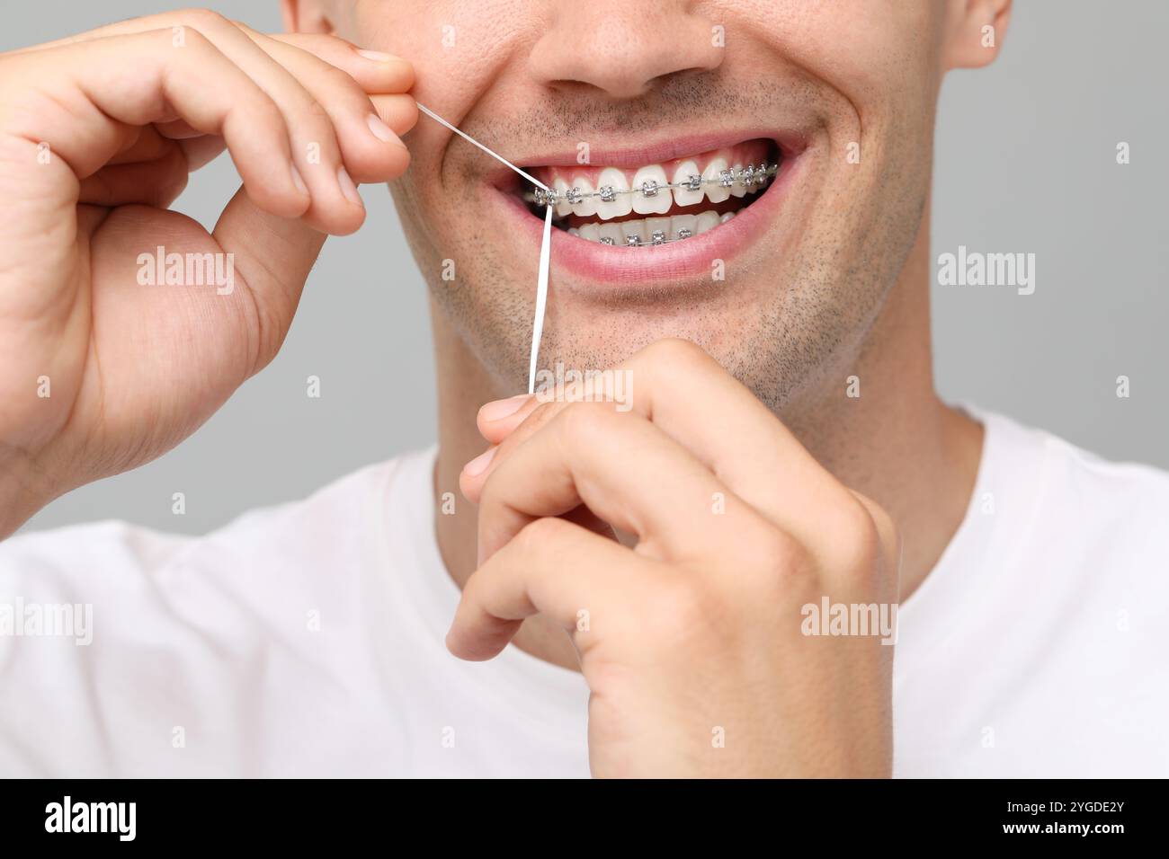 Man with braces cleaning teeth using dental floss on grey background ...