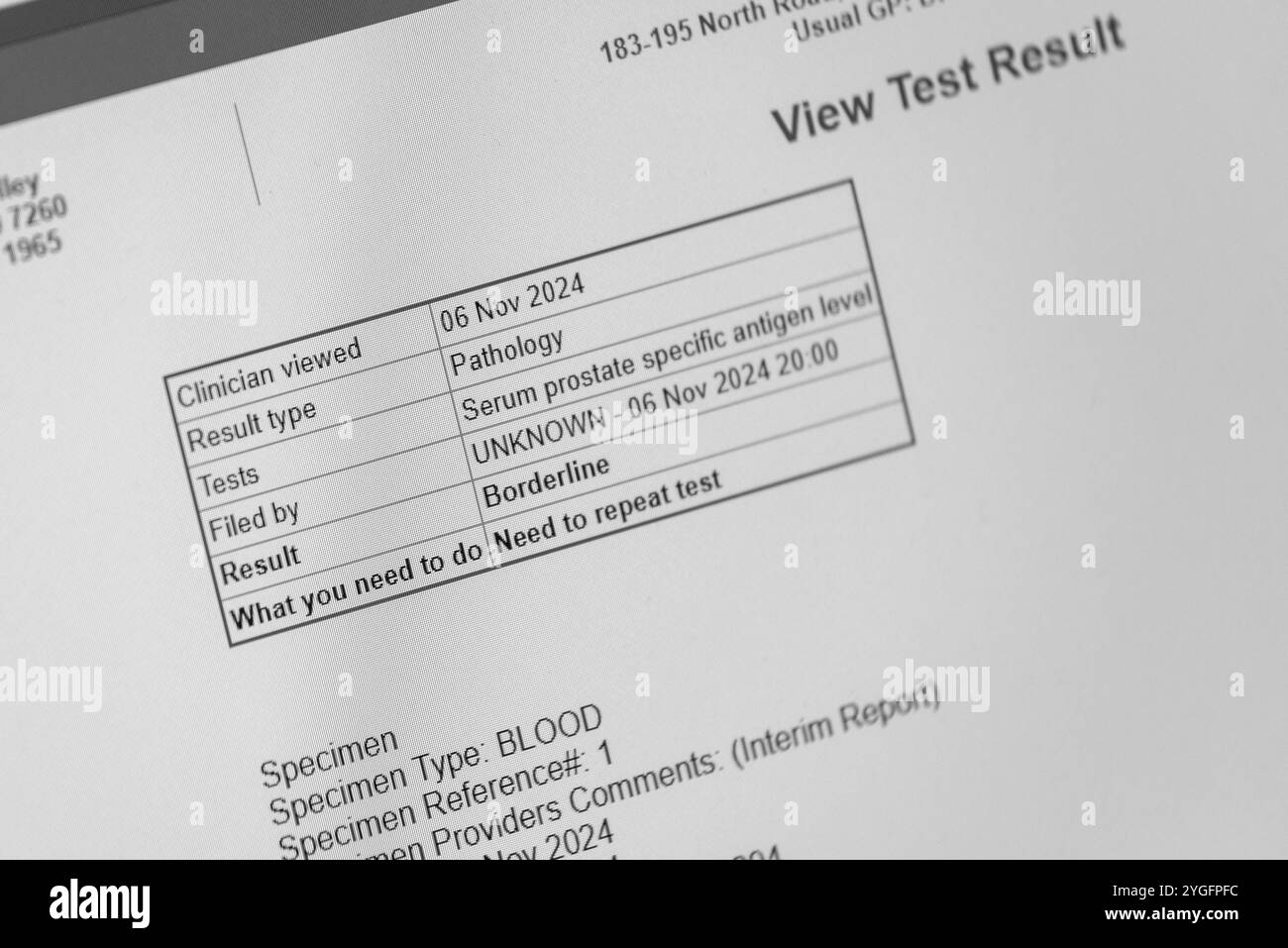 Prostate-specific antigen blood test result on a PC screen. Pathology ...