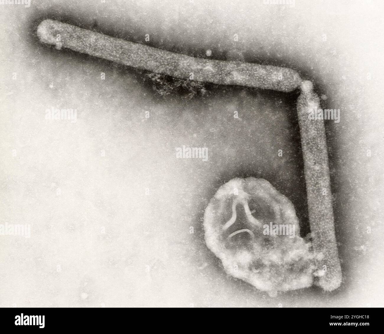 This undated electron microscopic image provided by the Centers for ...