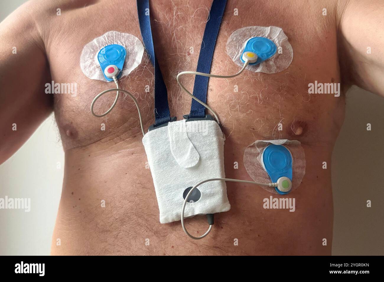 Munich, Deutschland. 08th Nov, 2024. Man with long-term ...