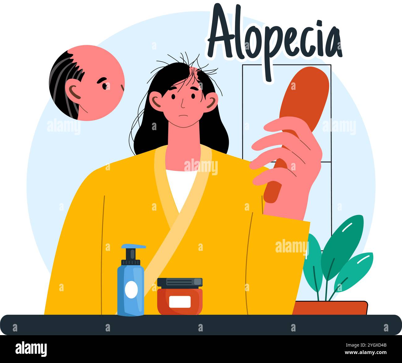 Alopecia Vector Illustration featuring Hair Loss due to Autoimmune ...