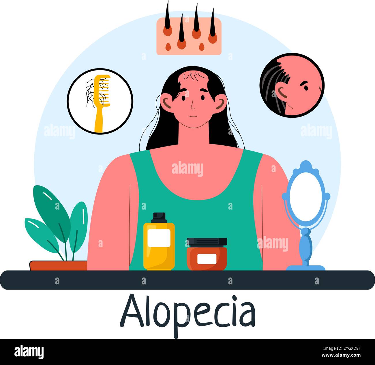 Alopecia Vector Illustration featuring Hair Loss due to Autoimmune ...