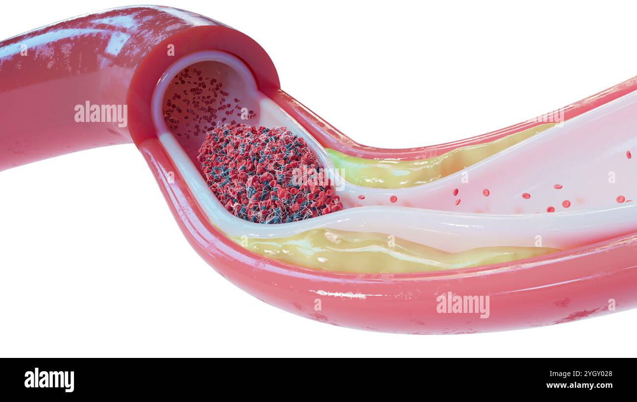 Blood blocks hi-res stock photography and images - Alamy