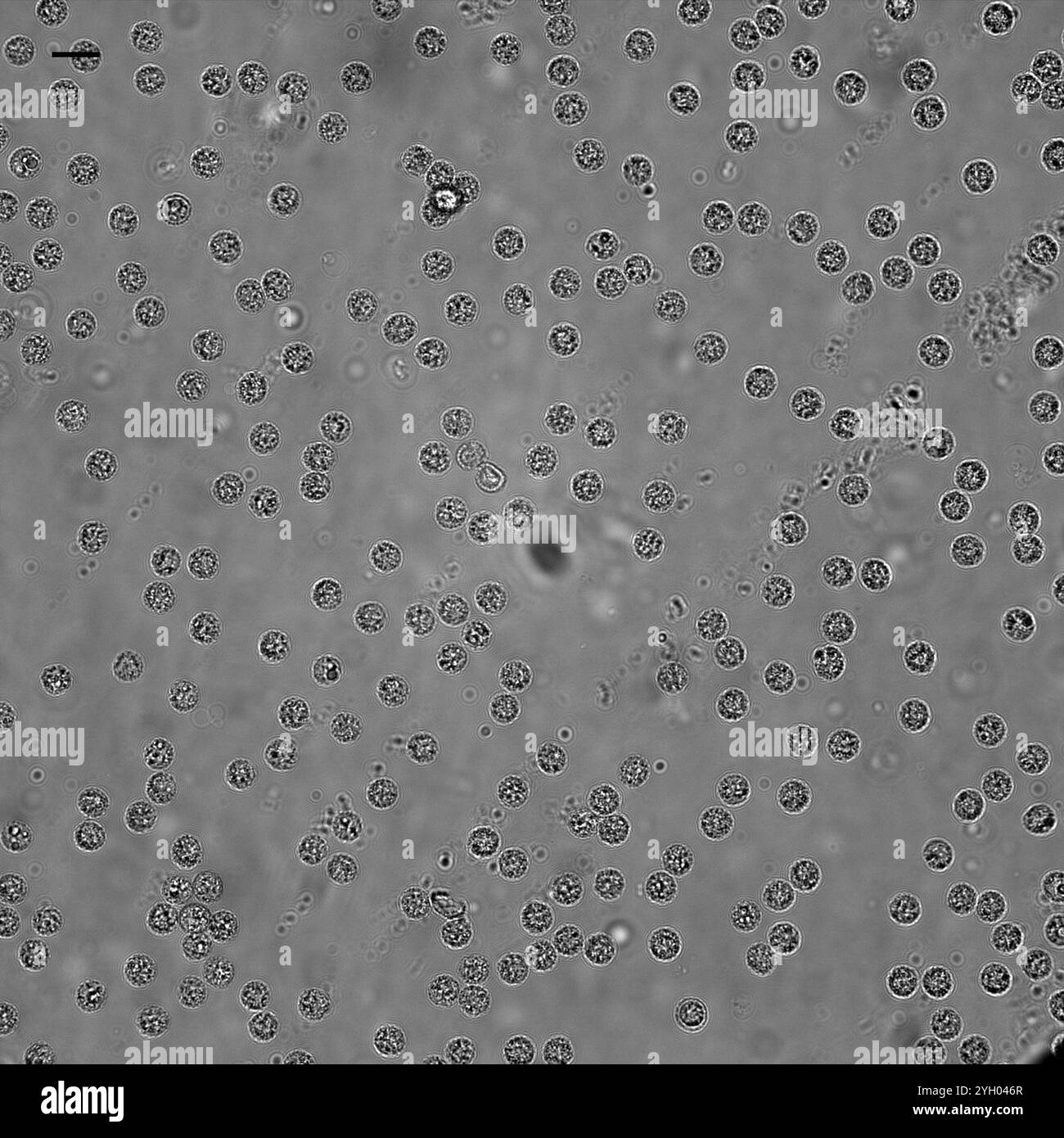 Lycogala epidendrum Black and White Stock Photos & Images - Alamy