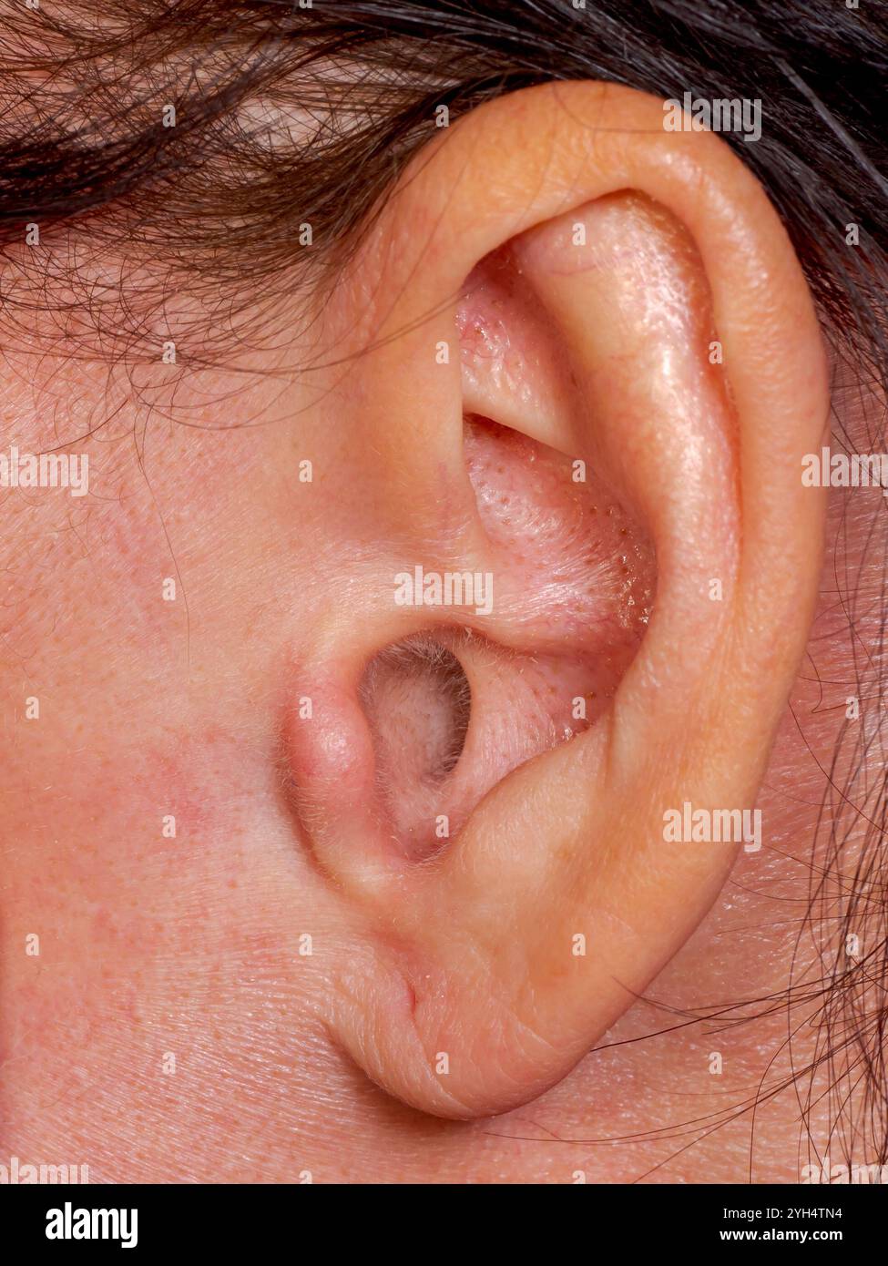 human ear close up photo, macro lots of detail Stock Photo - Alamy